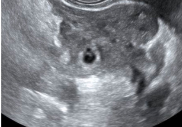 What's the diagnosis? By Dr. Abby Renko | EM Daily